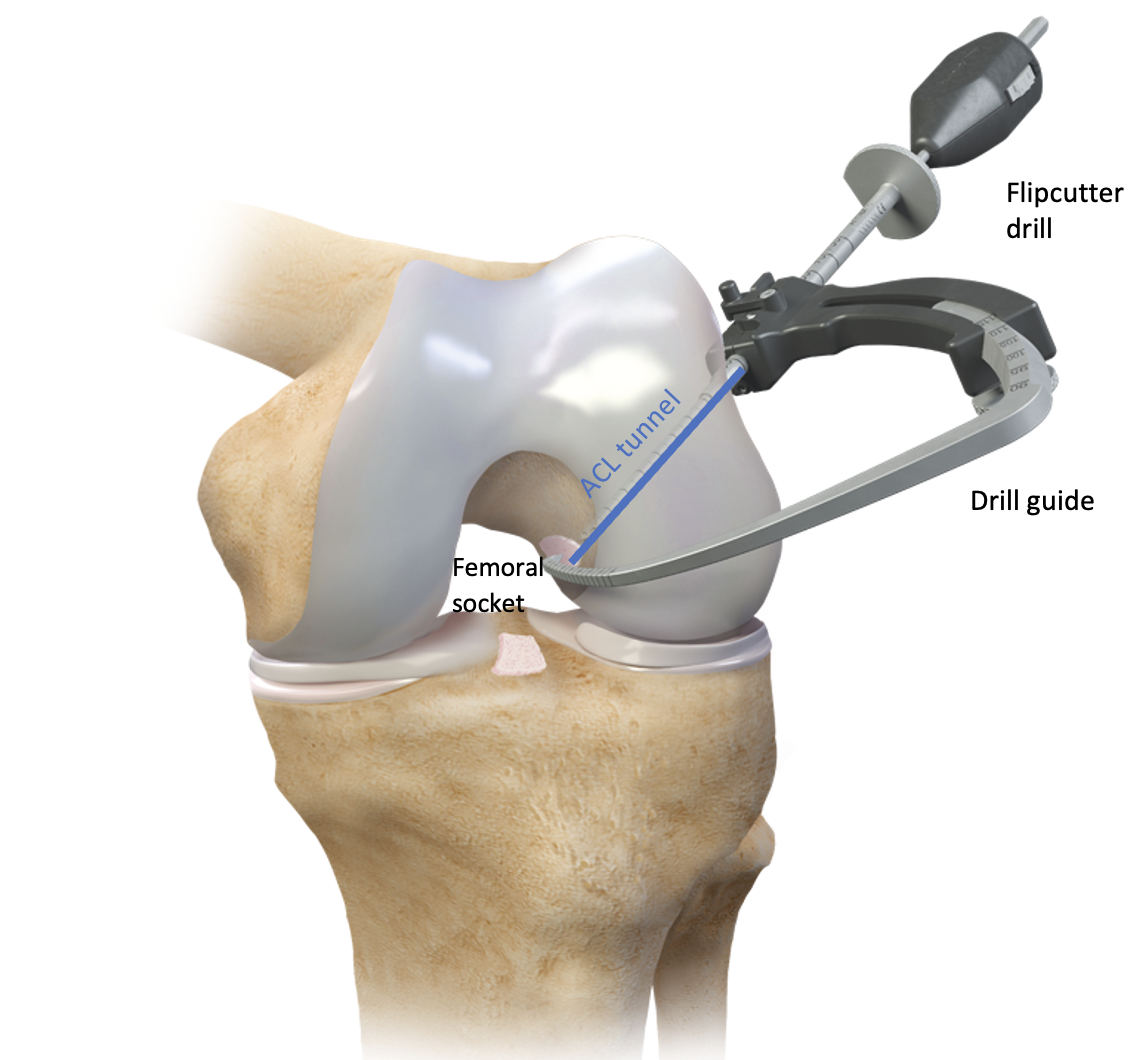 Design Inspiration and Intent (Dune) – ARID